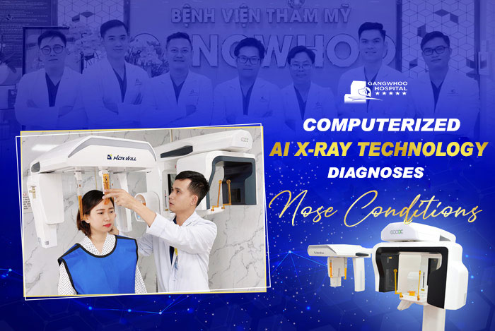 Surgiform Rhinoplasty - The Best Solution For A Luxurious Nose