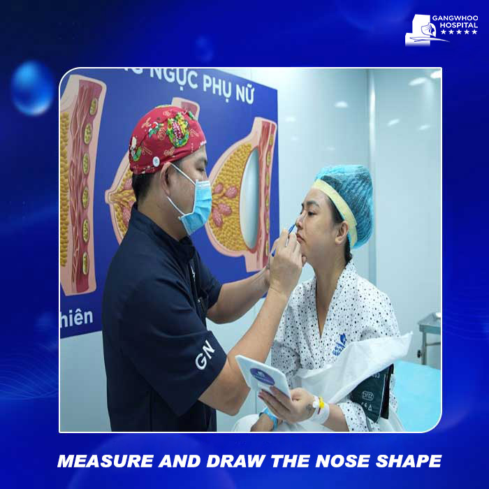 Surgiform Rhinoplasty - The Best Solution For A Luxurious Nose