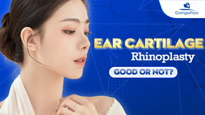 Ear cartilage Rhinoplasty: Good or Not? - Experts Explain