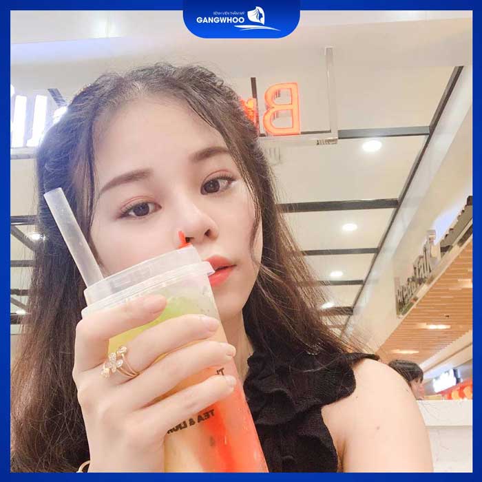 Chia Sẻ Hành Trình Cắt Mí Mắt Của TikToker Phan Yến Nhi Tại BVTM Gangwhoo