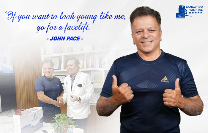 SMAS Facelift: The Secret to John Pace’s 20-Year Youthful Transformation